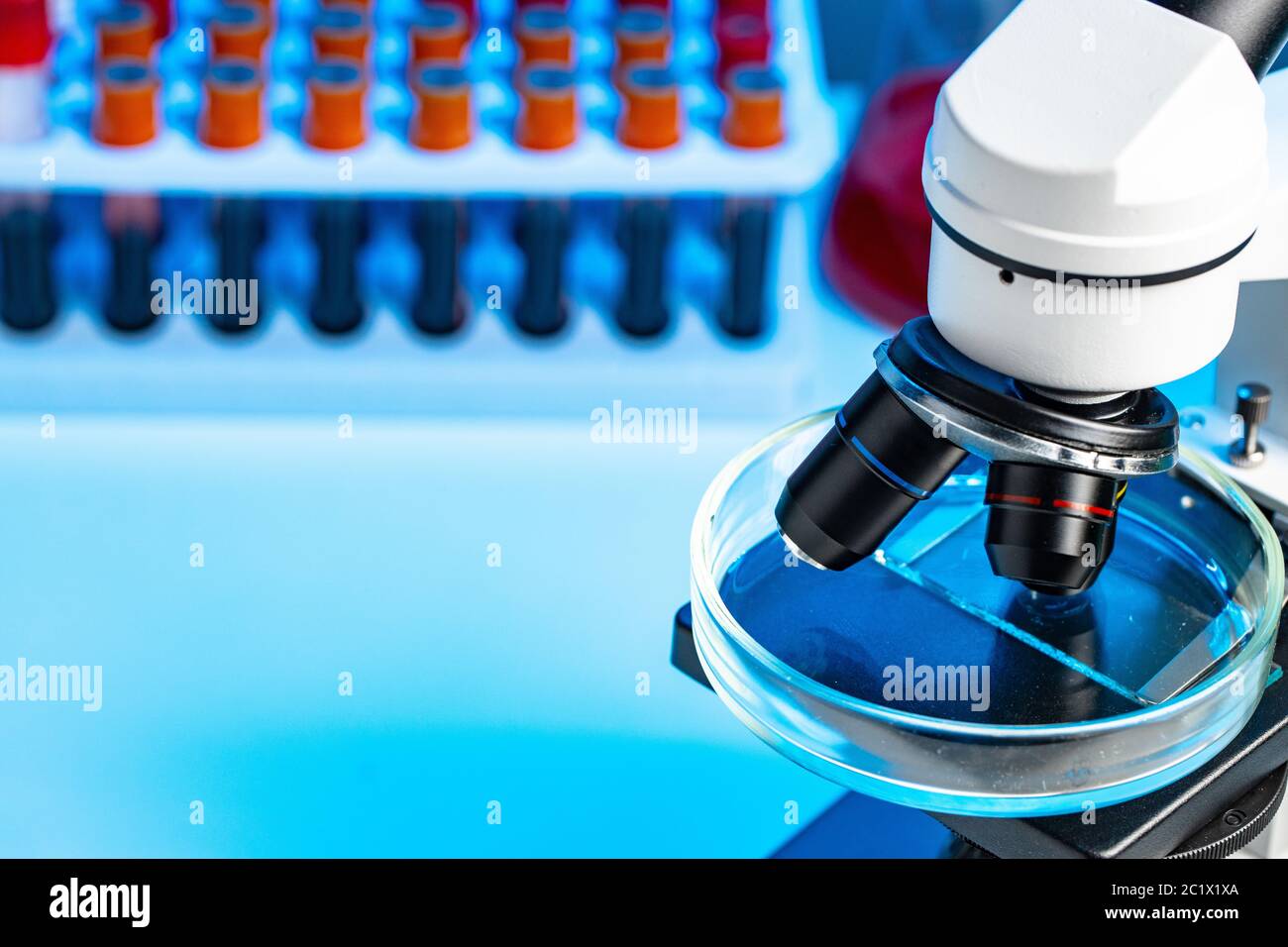 Close up photo of microscope with test tubes with blood samples Stock ...