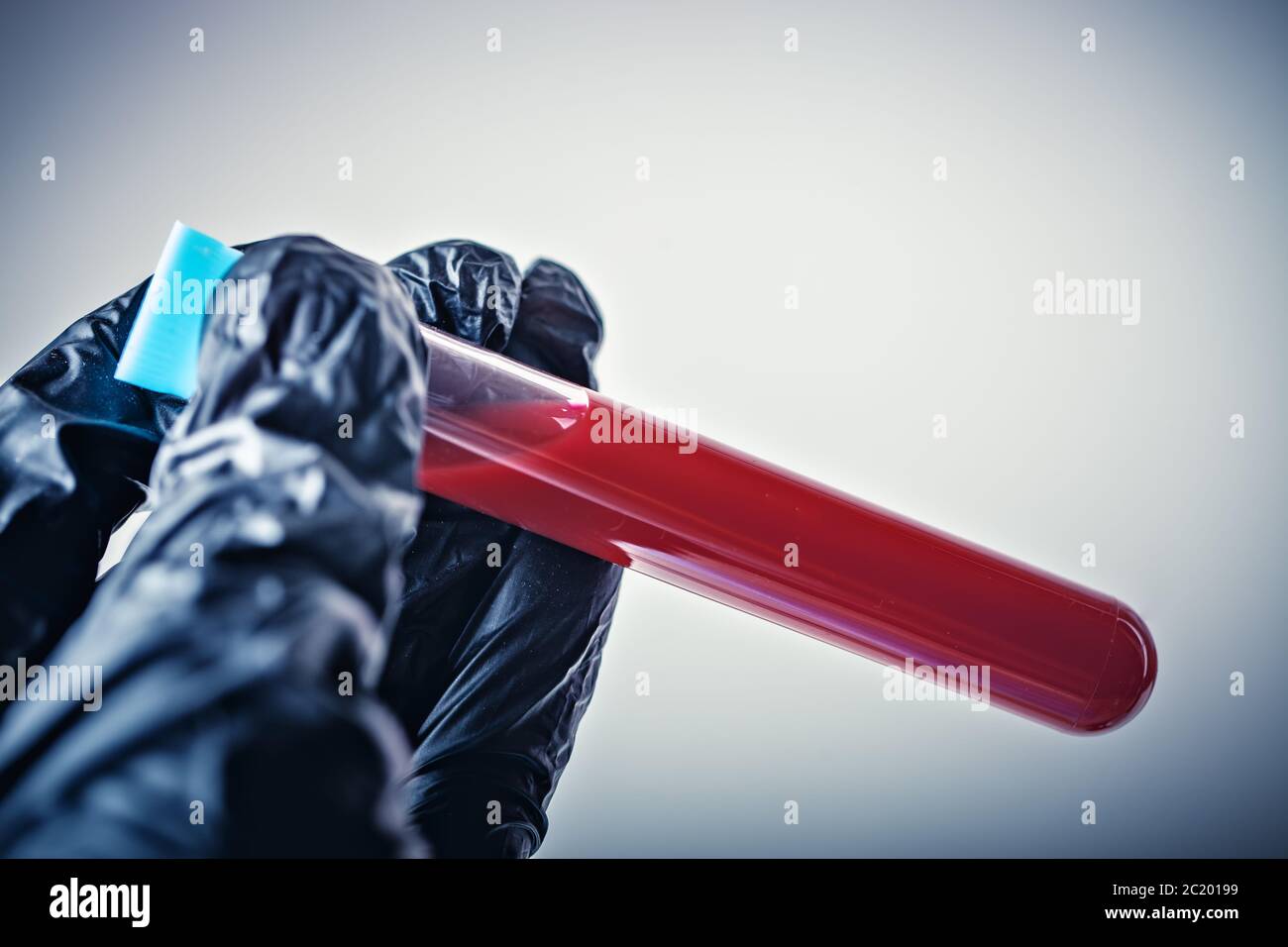 A test tube with a blood test in a medical laboratory. Background with ...