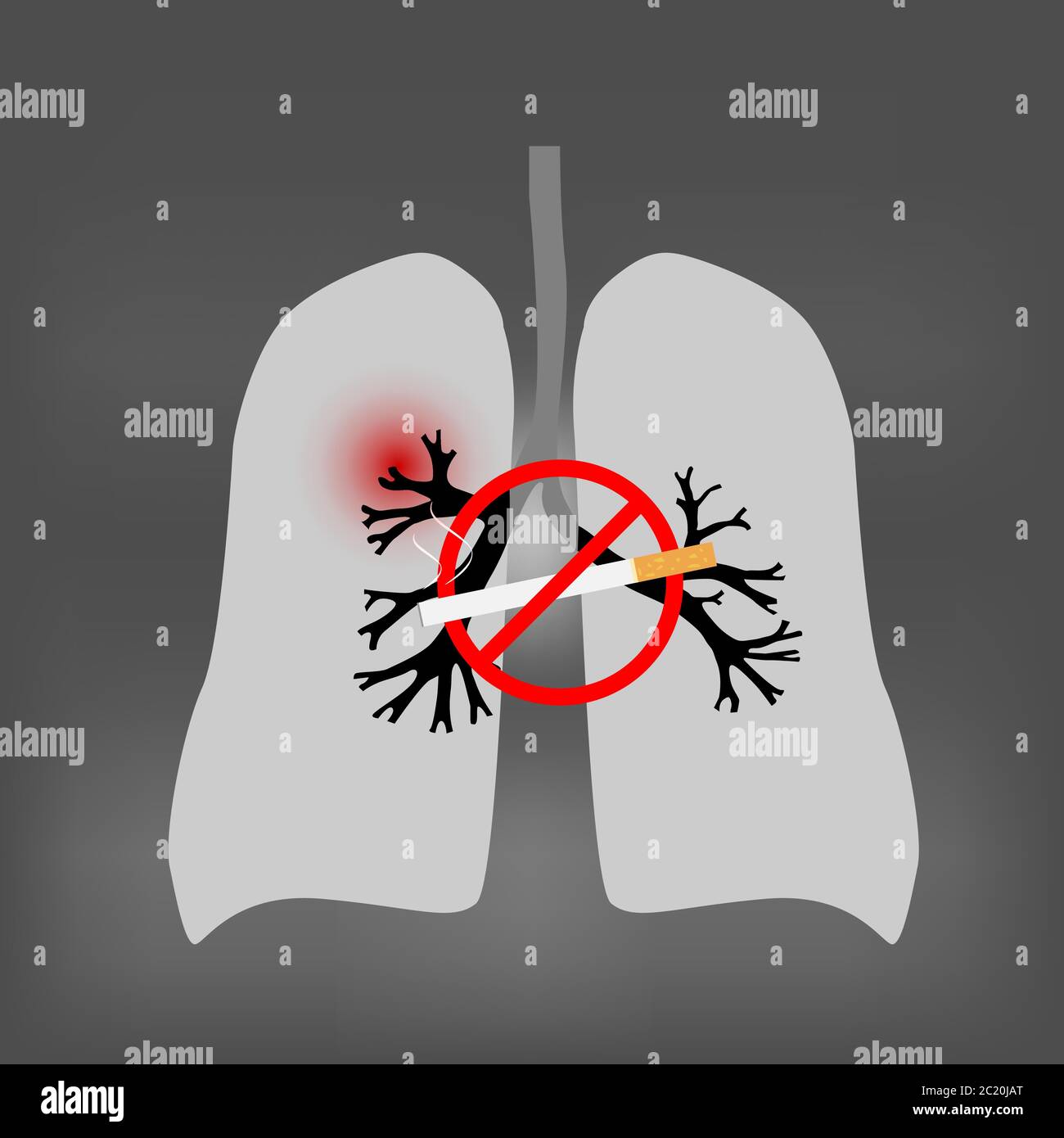 Smoking Causes Cancer