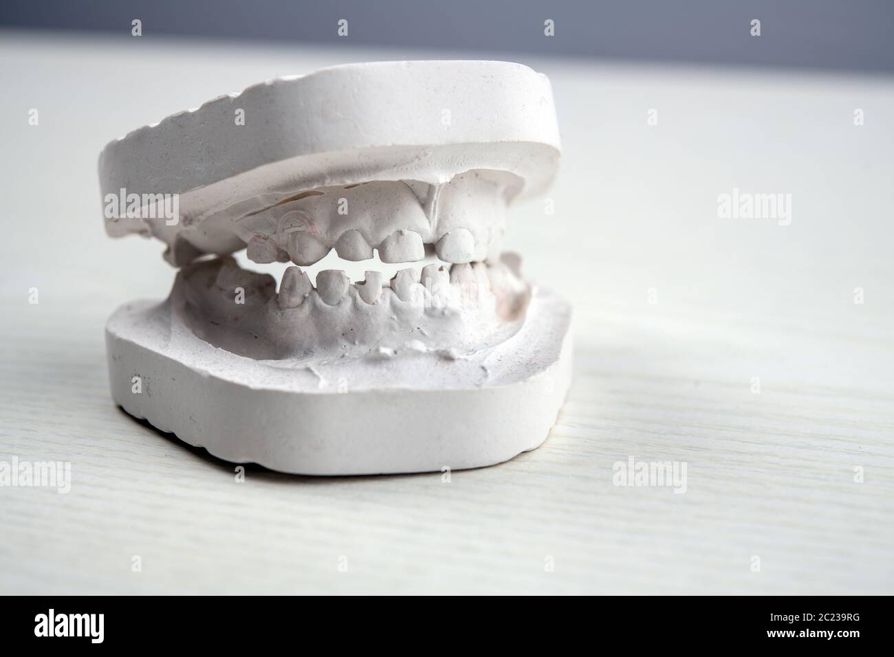 Plaster model of teeth hi-res stock photography and images - Alamy