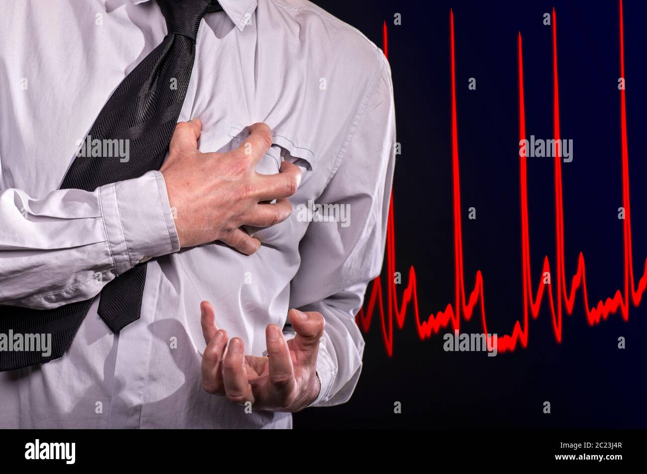 Symbol photo Heart attack Stock Photo - Alamy