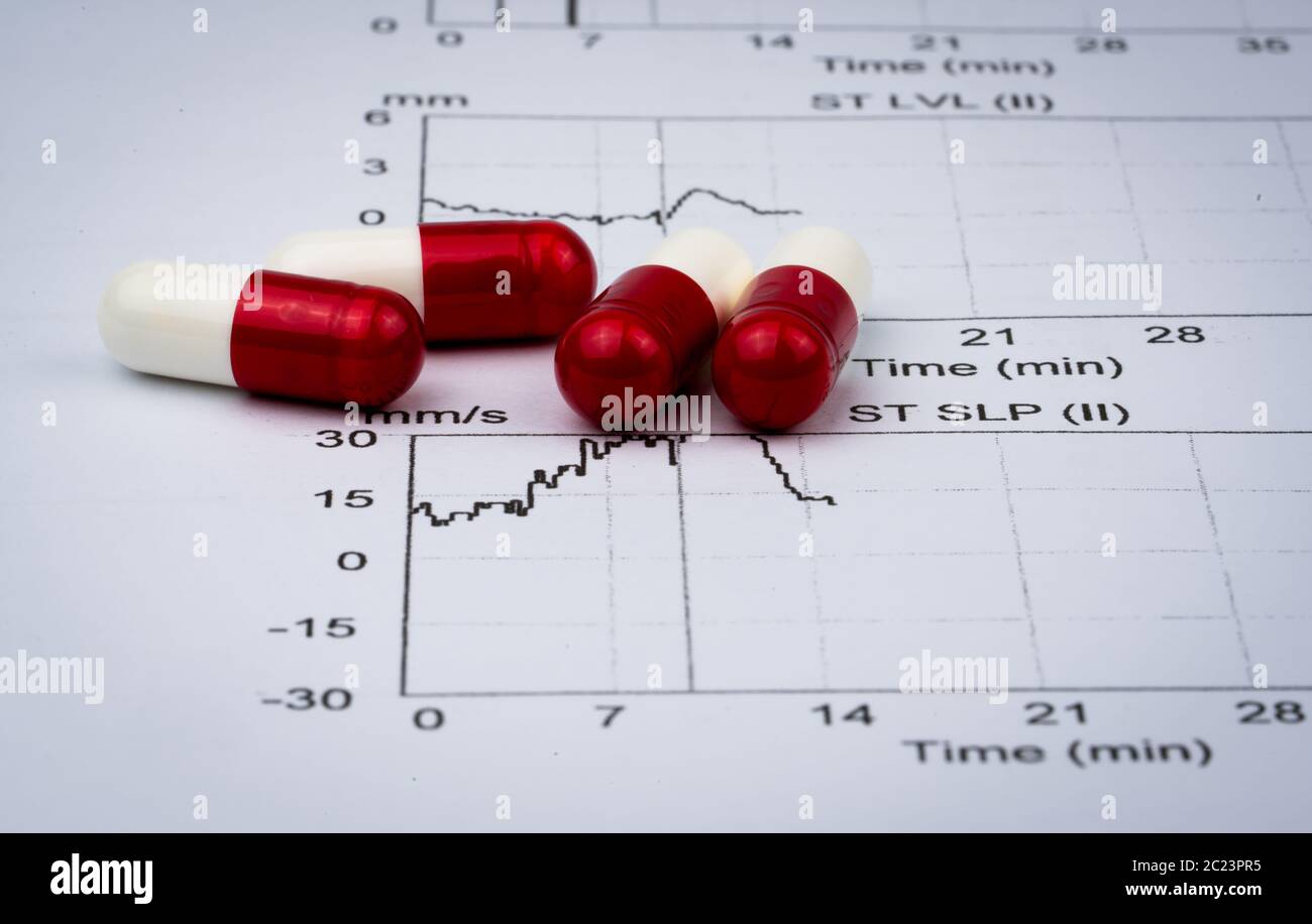Stress test ecg ekg hi-res stock photography and images - Alamy