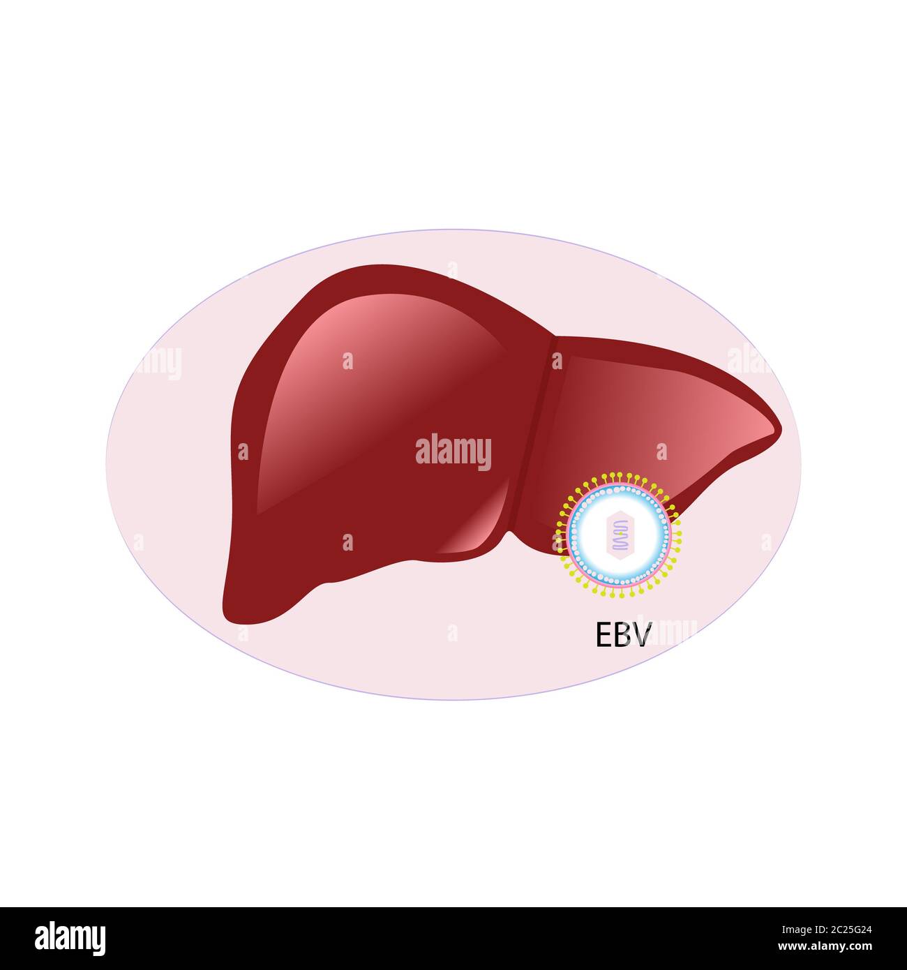 Infectious mononucleosis hi-res stock photography and images - Alamy