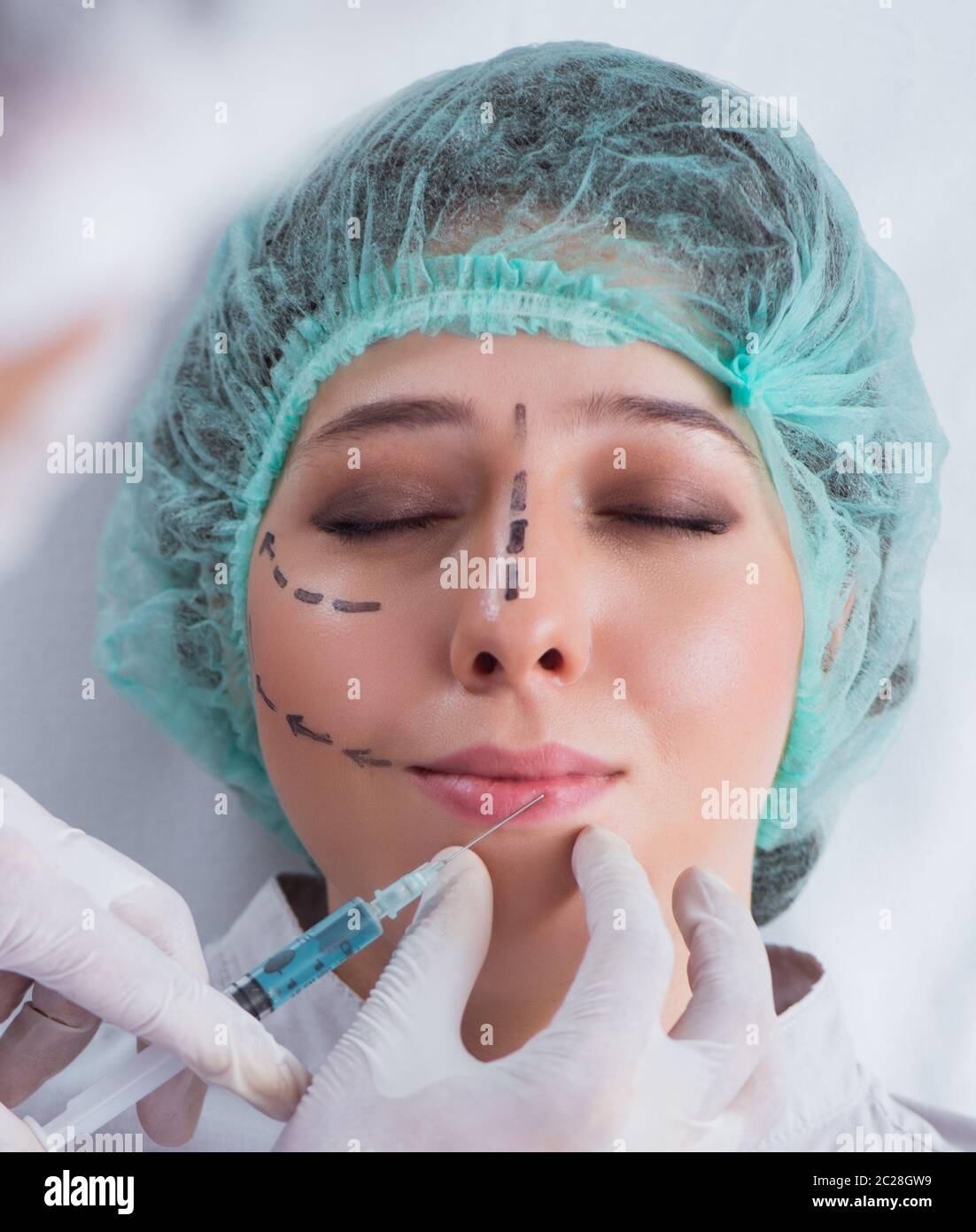 Plastic surgeon preparing for operation on woman face Stock Photo - Alamy