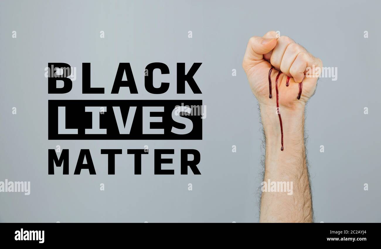 Blood bleeding hand hi-res stock photography and images - Alamy