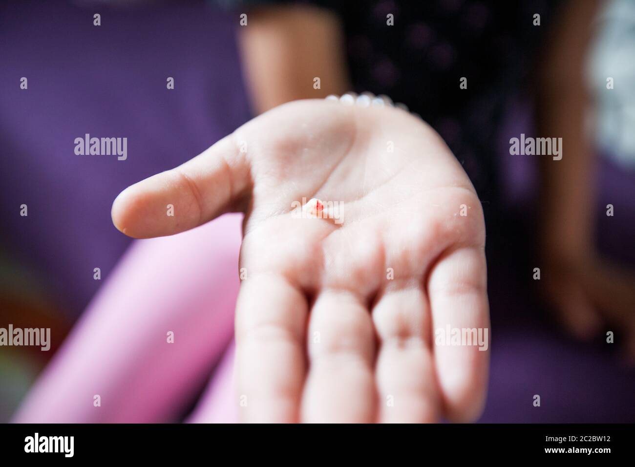 Closeup view of child hand showing dropped first milk teeth Stock Photo ...