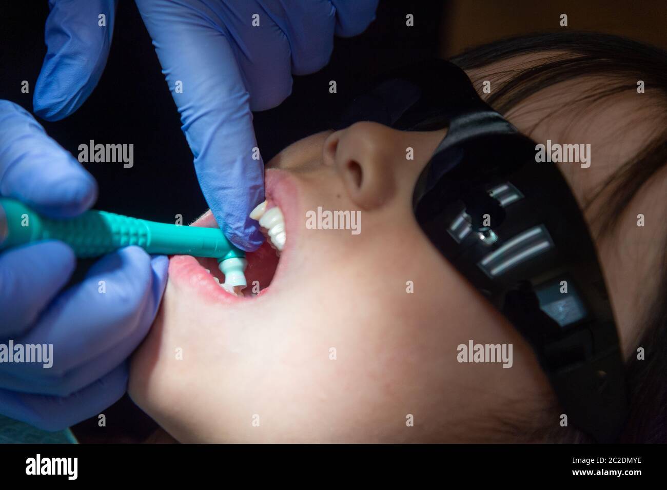 Polished teeth hi-res stock photography and images - Alamy