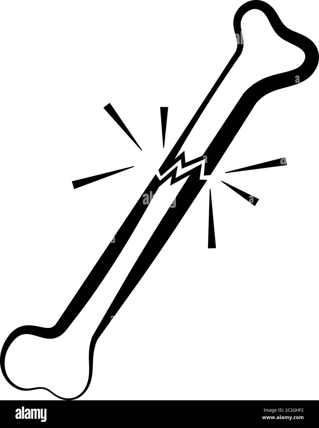 Bone fracture heal illustration Stock Vector Images - Alamy