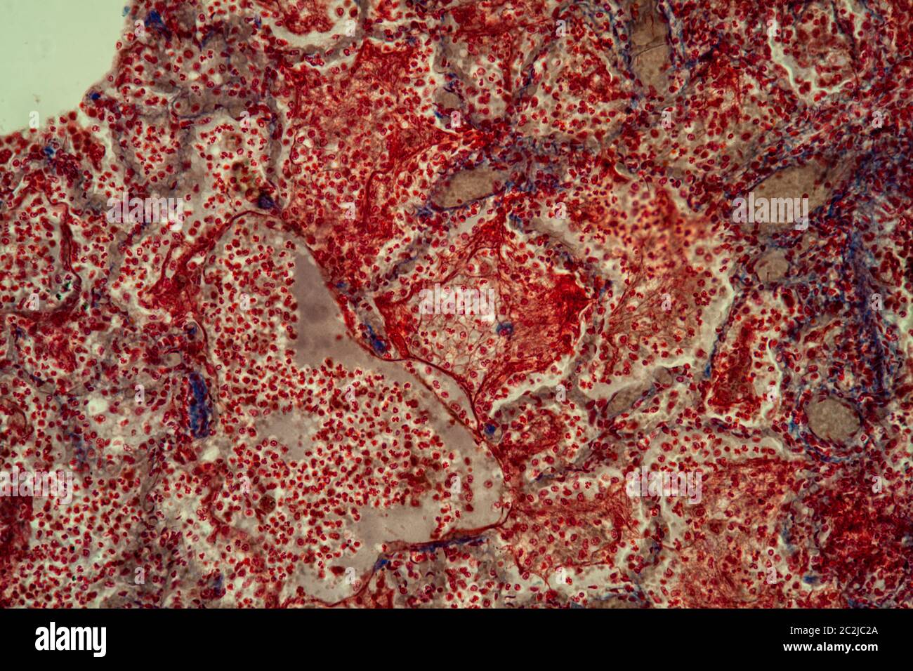 Tuberculosis microscope hi-res stock photography and images - Alamy