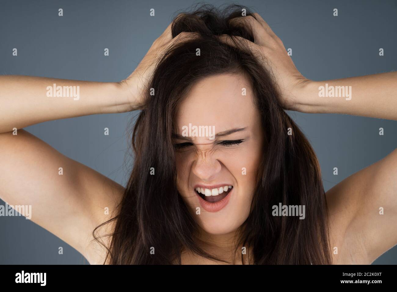 Young Woman Scratching Her Itchy Head Scalp Stock Photo - Alamy