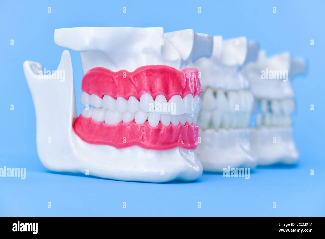 Human jaws with teeth and gums anatomy models Stock Photo - Alamy