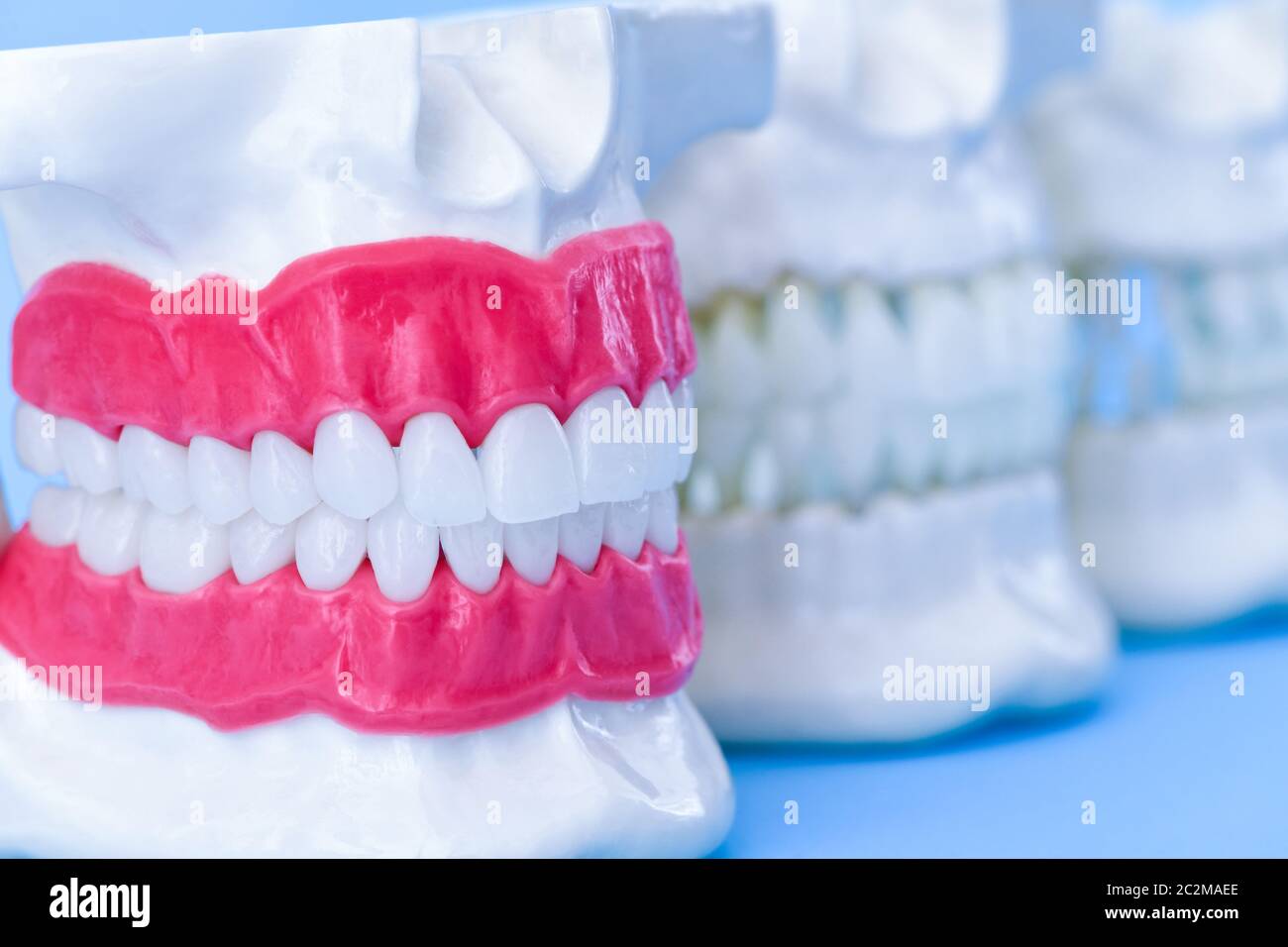 Human jaws with teeth and gums anatomy models Stock Photo - Alamy
