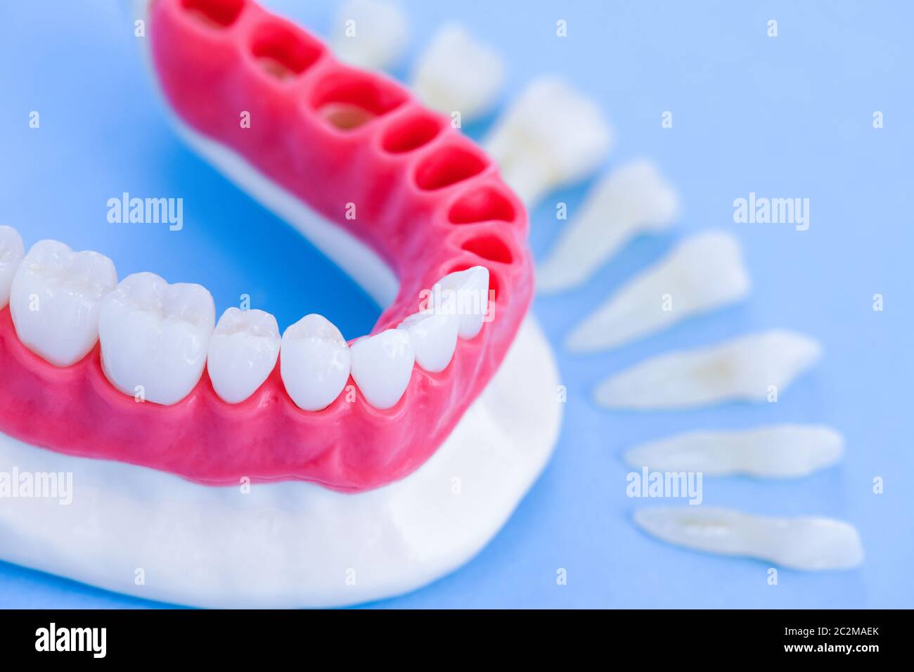Tooth implant and crown installation process Stock Photo - Alamy