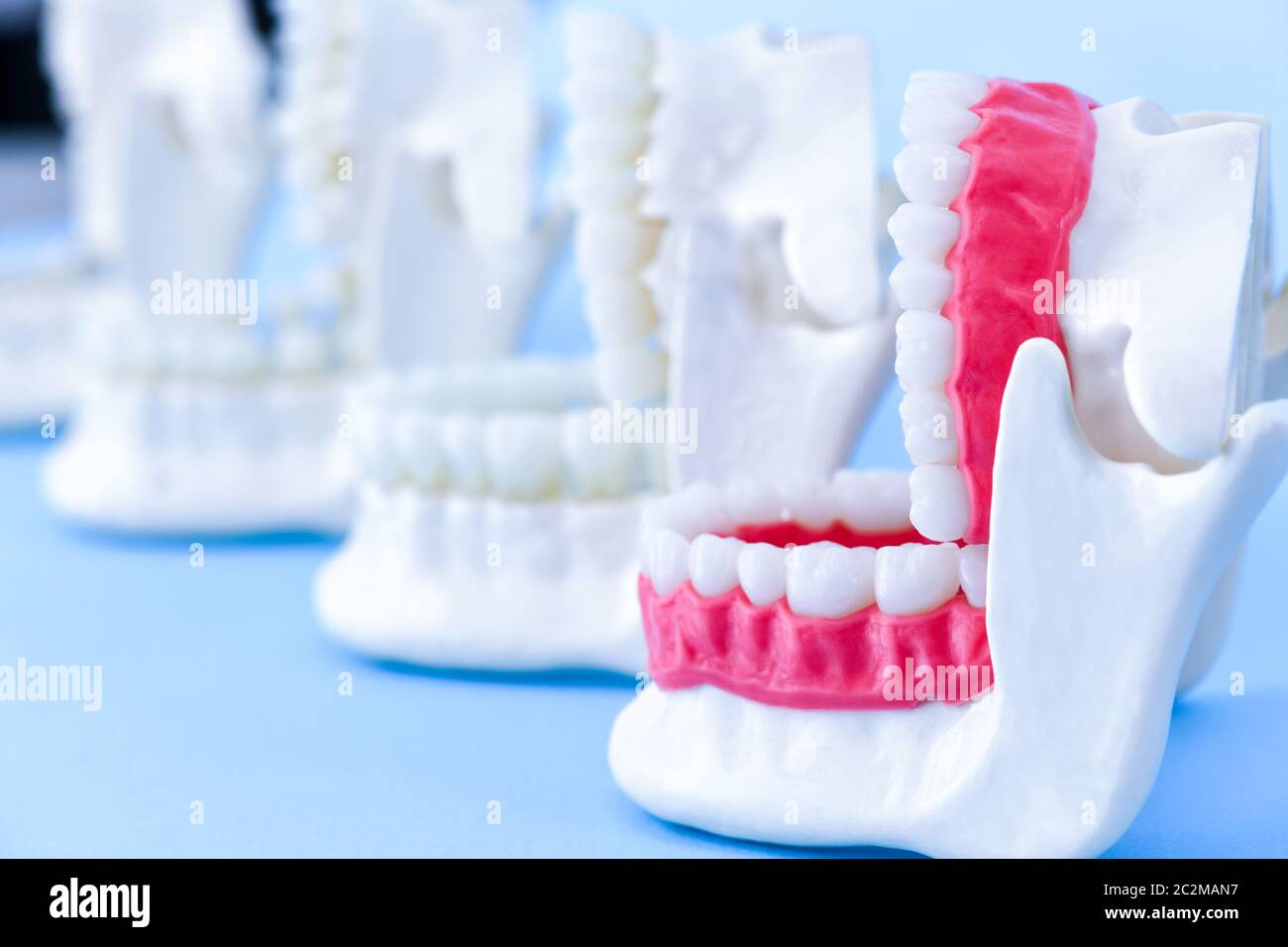 Dentist orthodontic teeth models Stock Photo - Alamy