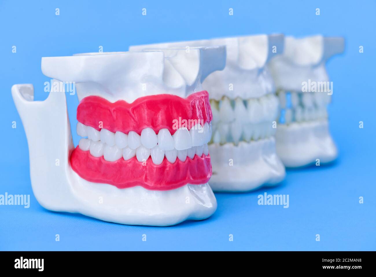 Human jaws with teeth and gums anatomy models Stock Photo - Alamy