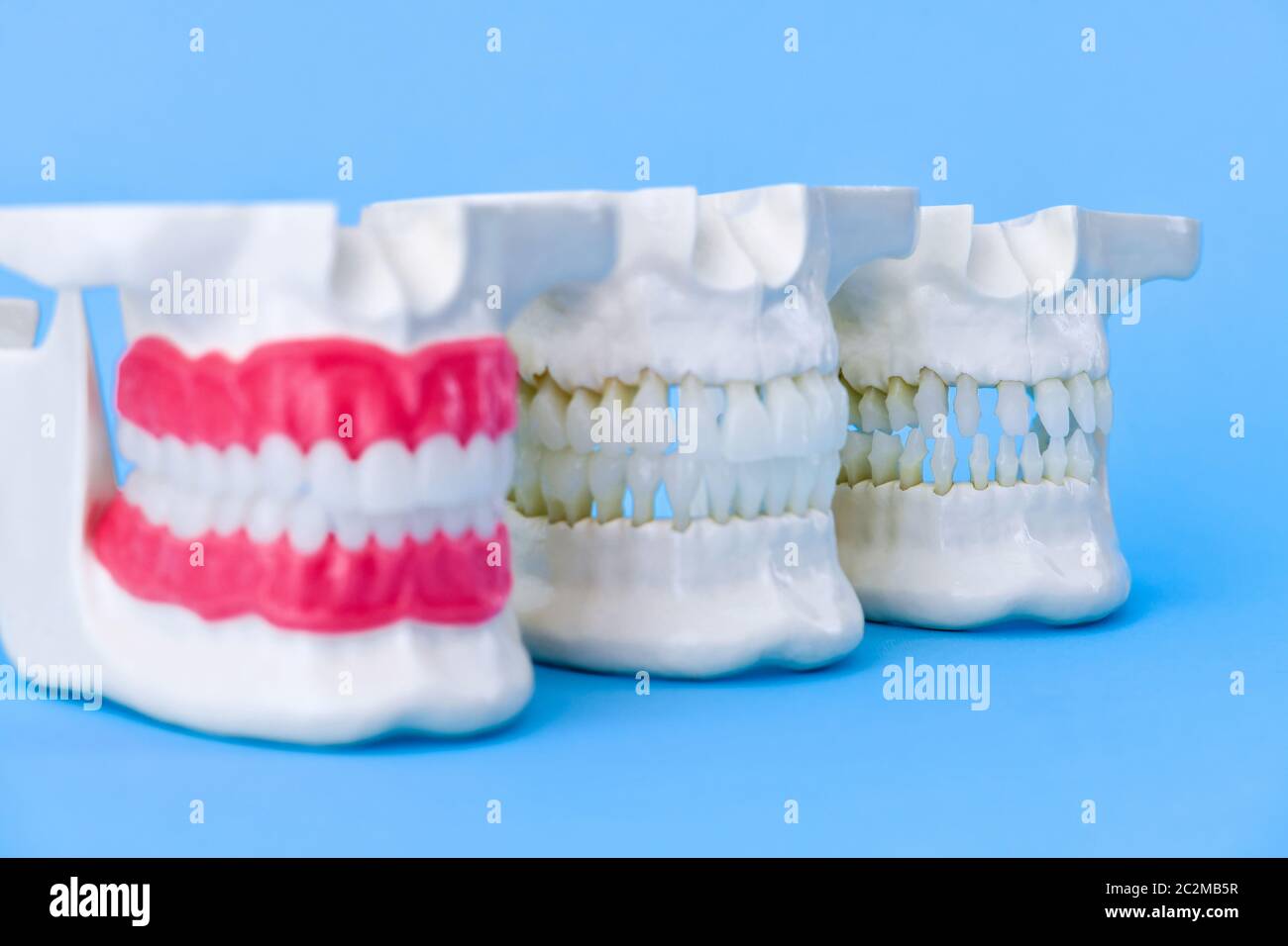 Human jaws with teeth and gums anatomy models Stock Photo - Alamy