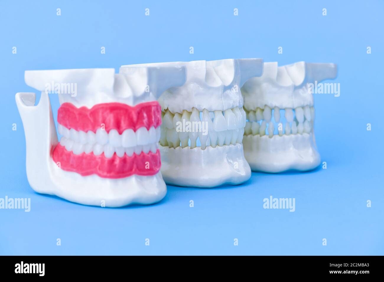 Human jaws with teeth and gums anatomy models Stock Photo - Alamy