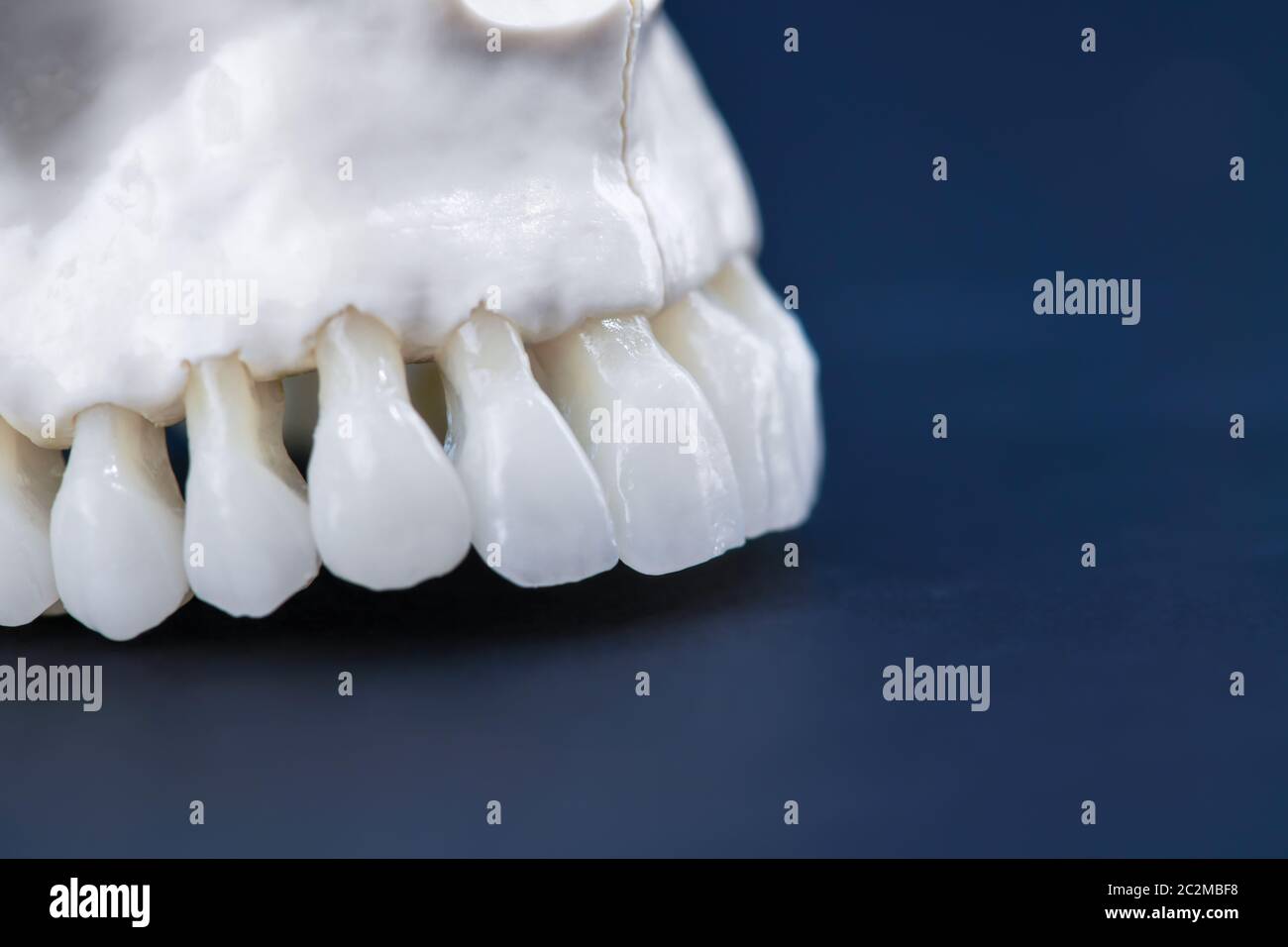 Upper human jaw with teeth Stock Photo - Alamy