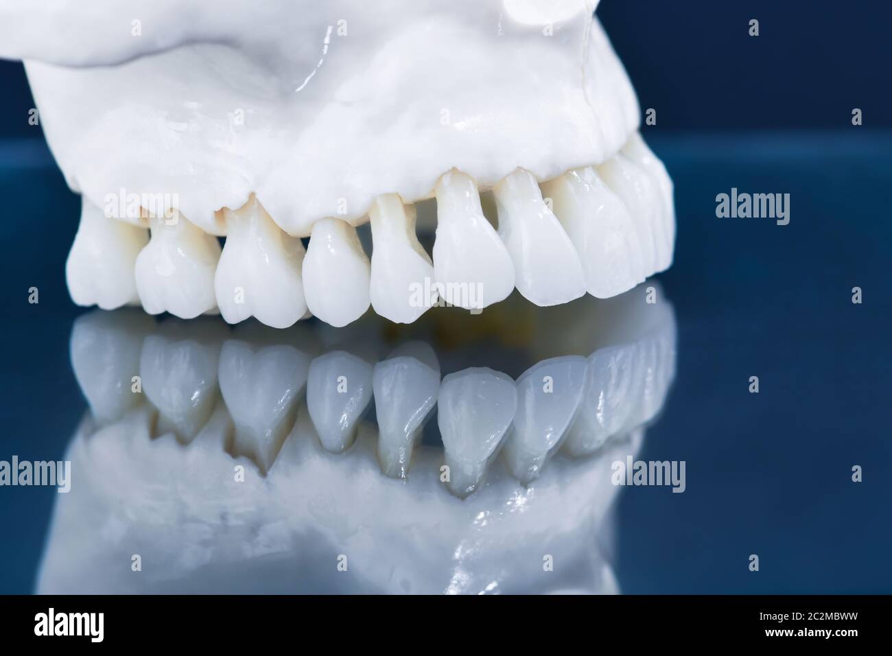 Upper human jaw model with a reflection on the glass Stock Photo - Alamy