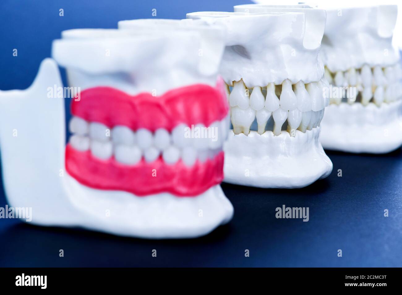 Human jaws with teeth and gums anatomy models Stock Photo - Alamy