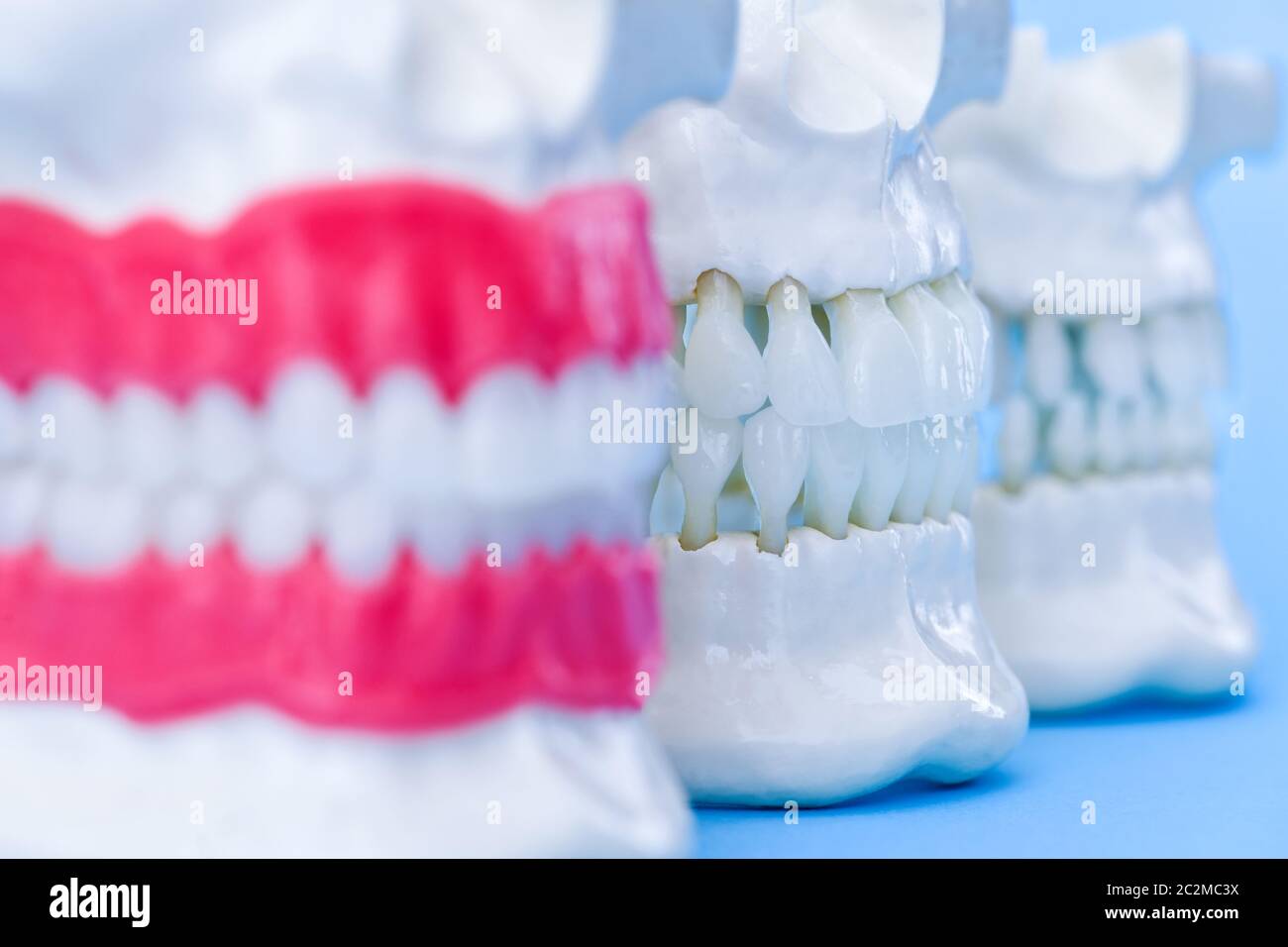 Human jaws with teeth and gums anatomy models Stock Photo - Alamy