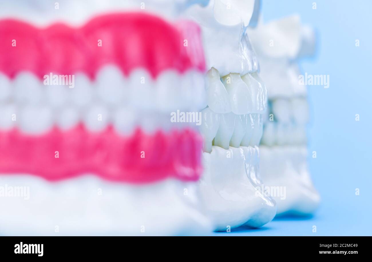 Human jaws with teeth and gums anatomy models Stock Photo - Alamy