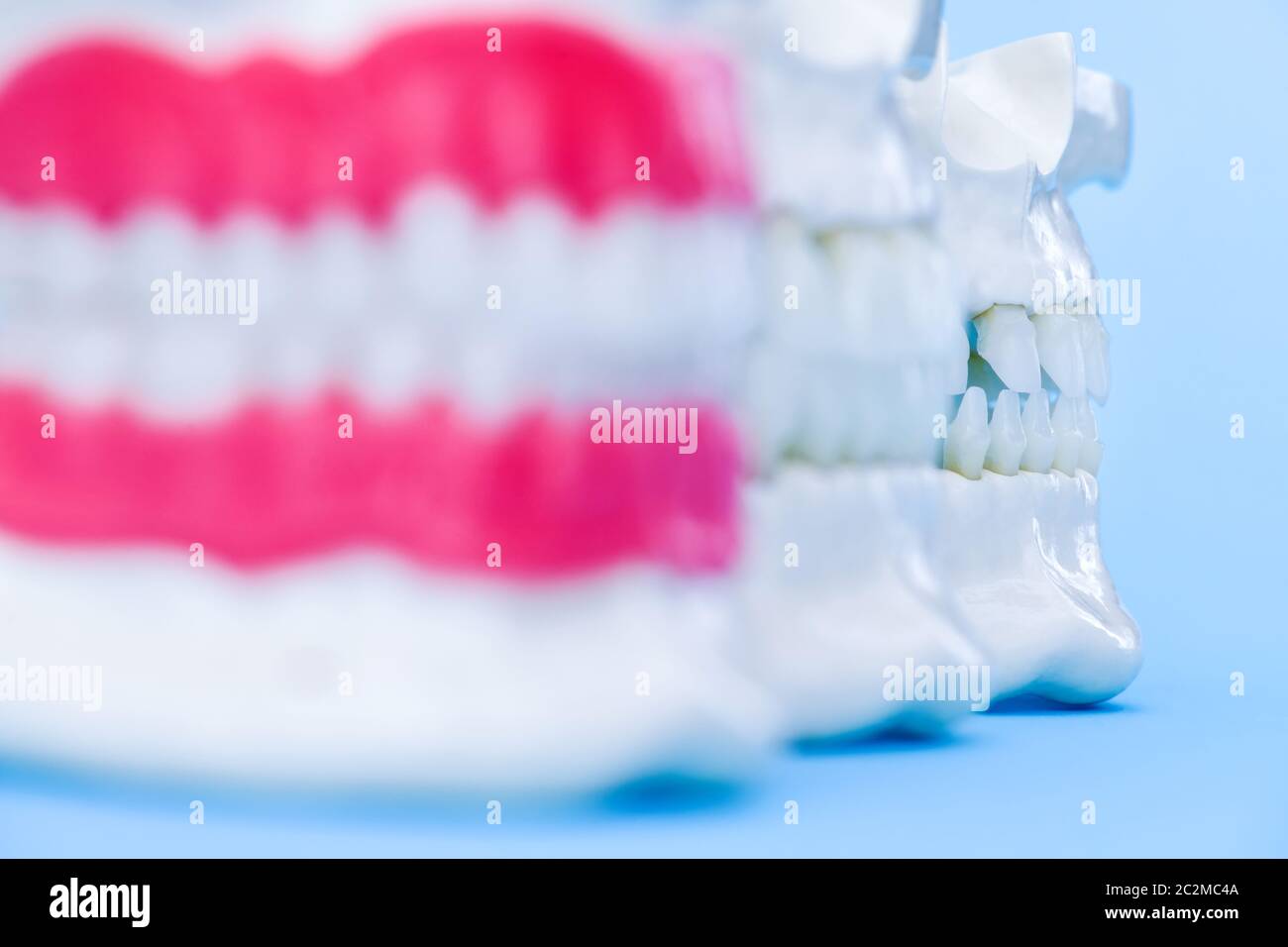 Human jaws with teeth and gums anatomy models Stock Photo - Alamy