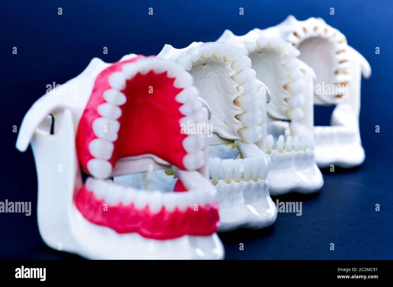 Dentist orthodontic teeth models Stock Photo - Alamy