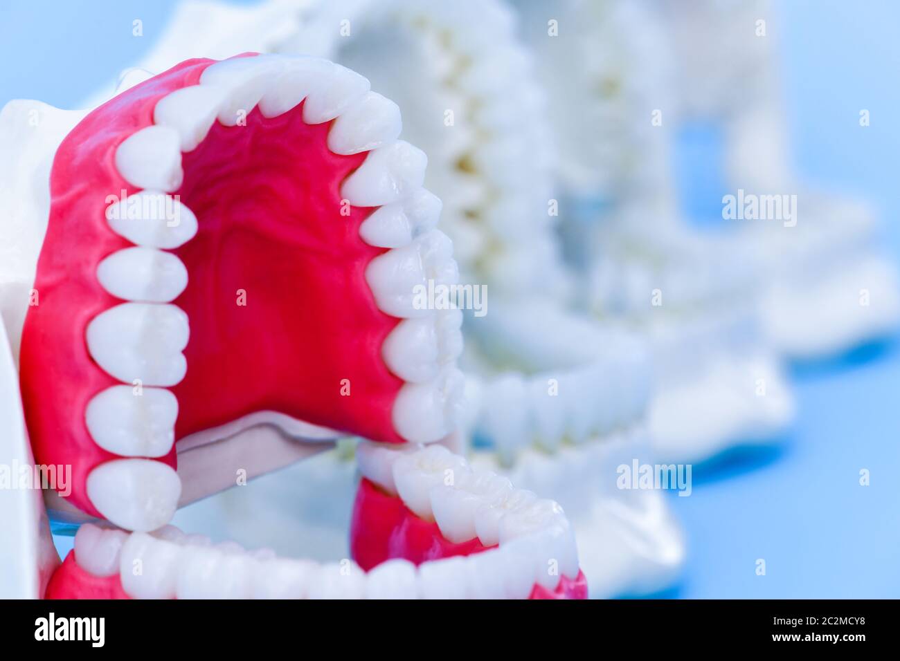 Dentist orthodontic teeth models Stock Photo - Alamy