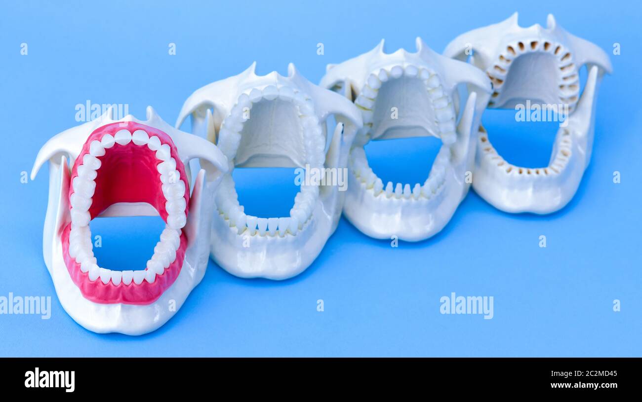 Dentist orthodontic teeth models Stock Photo - Alamy