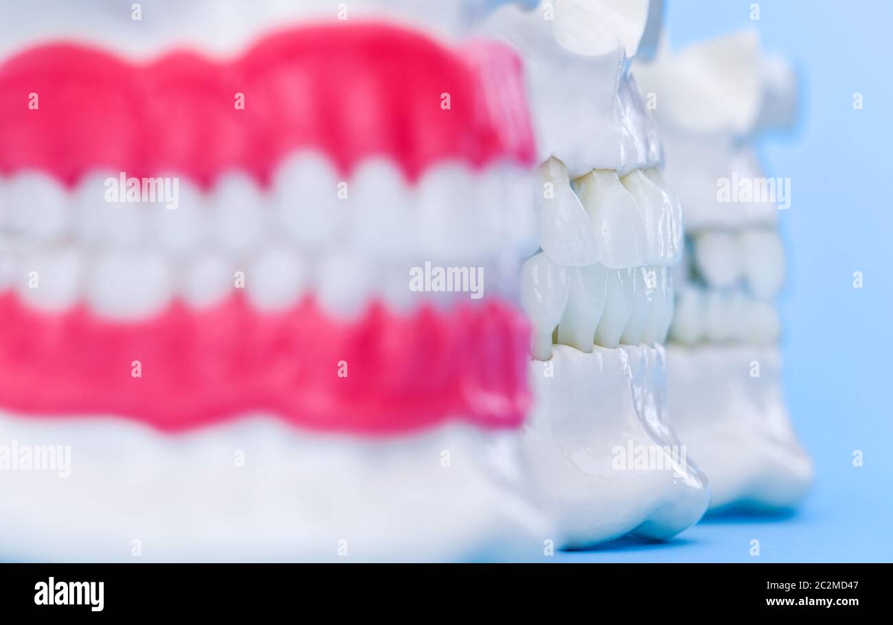 Human jaws with teeth and gums anatomy models Stock Photo - Alamy