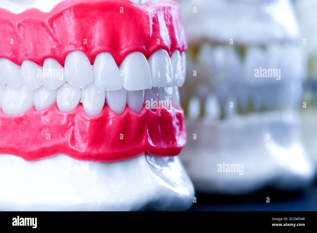 Human jaws with teeth and gums anatomy models Stock Photo - Alamy