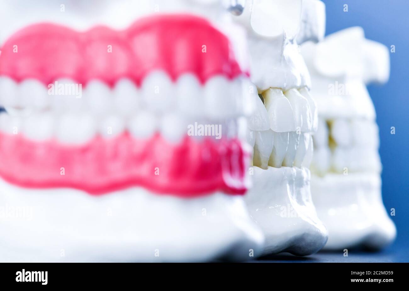 Human jaws with teeth and gums anatomy models Stock Photo - Alamy