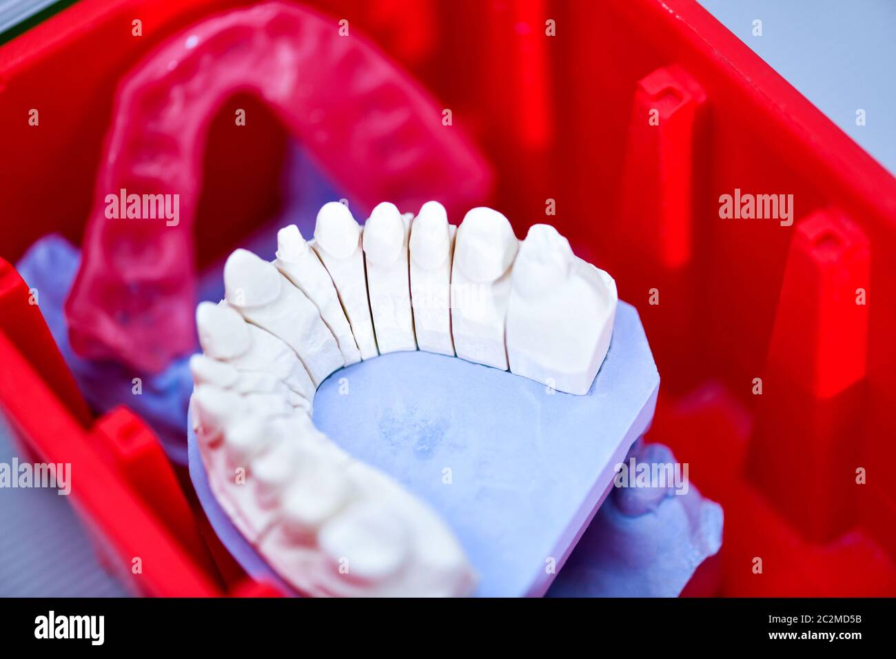 Gypsum model of human jaw Stock Photo - Alamy