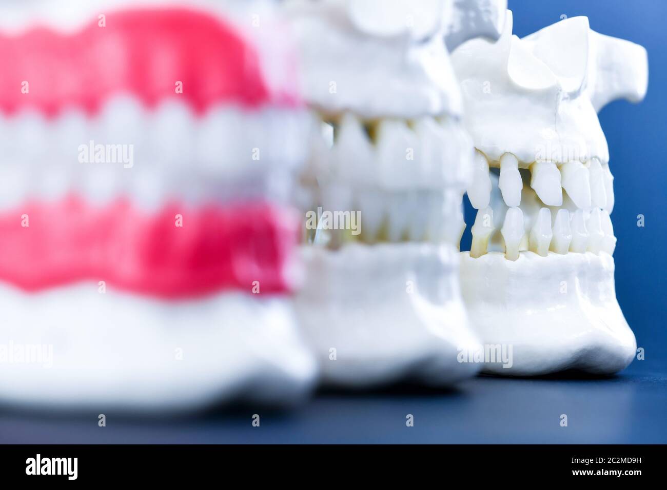 Human jaws with teeth and gums anatomy models Stock Photo - Alamy