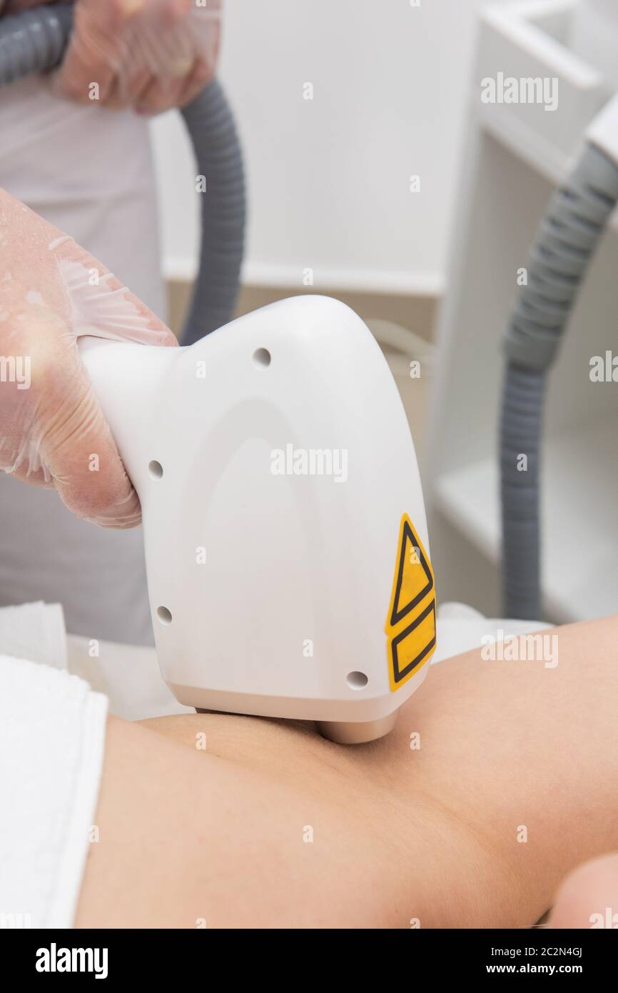 Laser epilation of armpits, hair removal cosmetology procedure. Health ...
