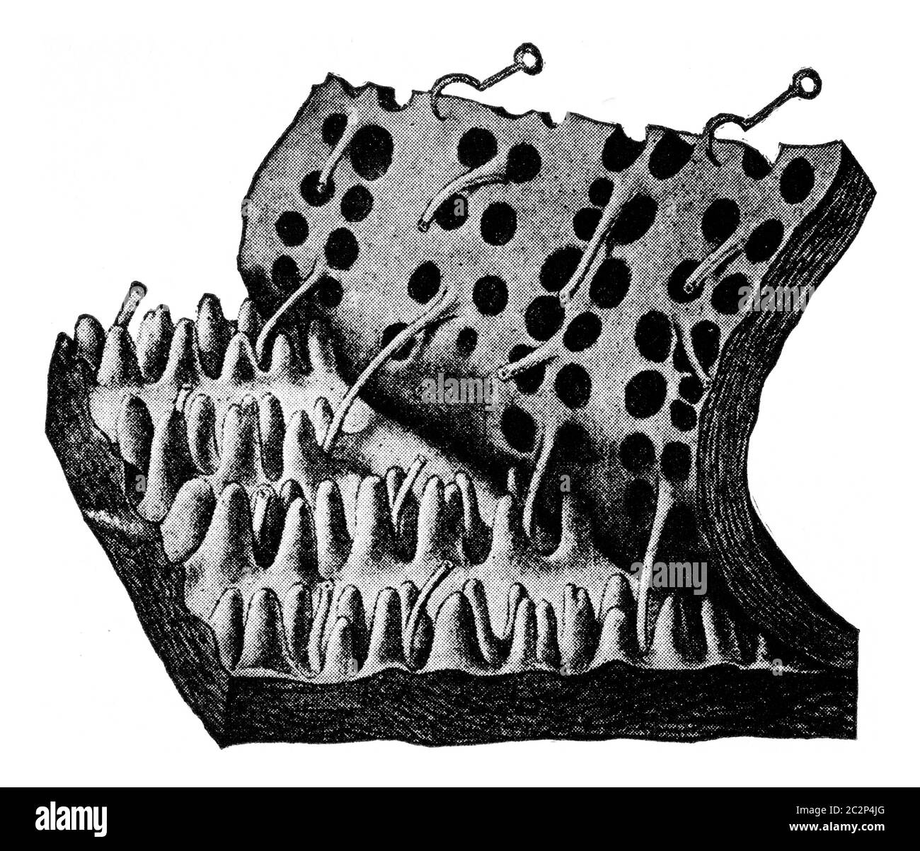 Skin with epidermis stripped off, vintage engraved illustration Stock ...