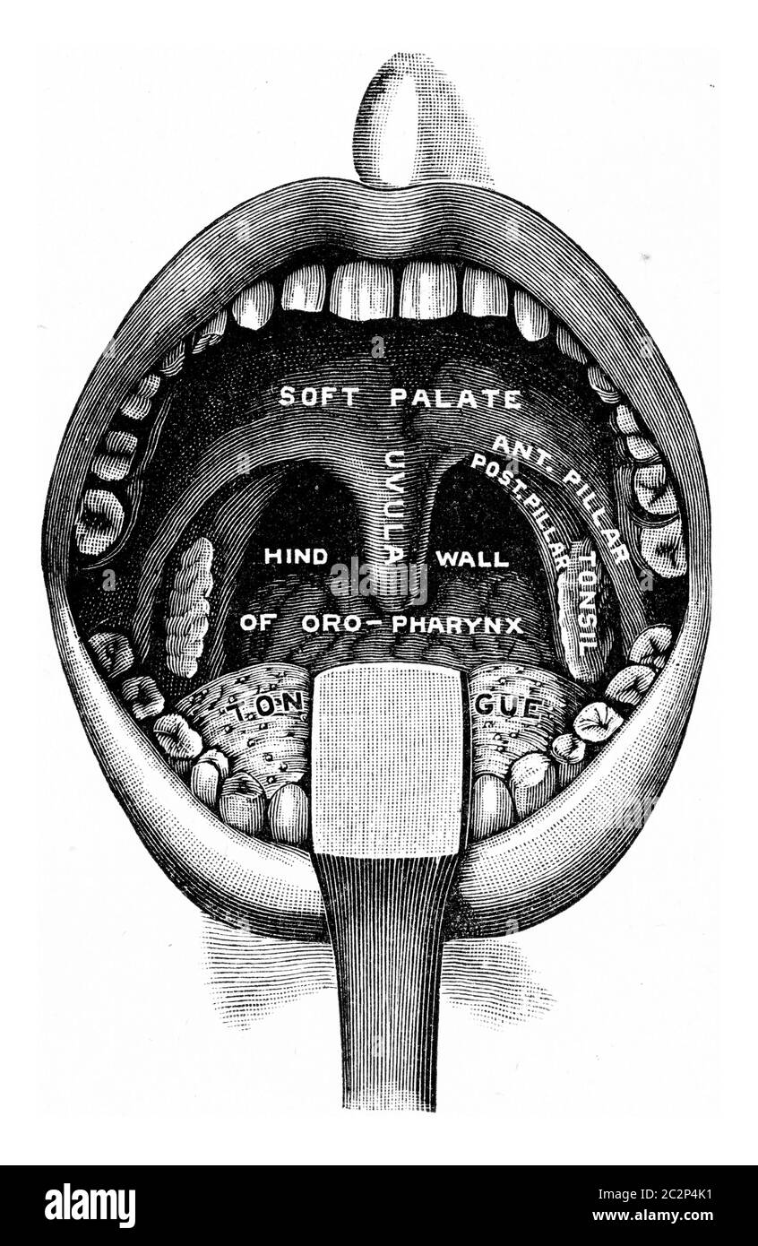 Uvula drawing Black and White Stock Photos & Images - Alamy