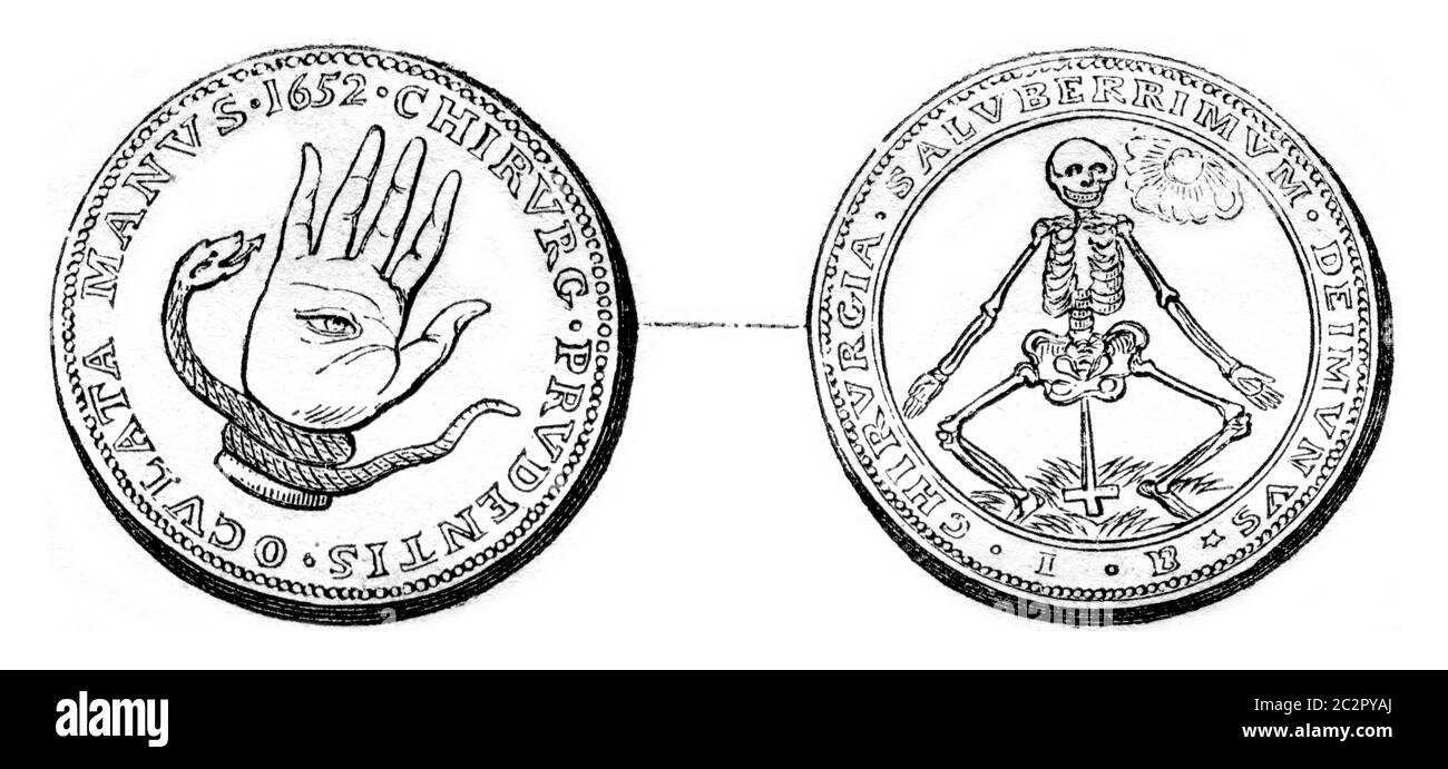 Token surgeon, At right, a hand in the middle of which is a look, The ...