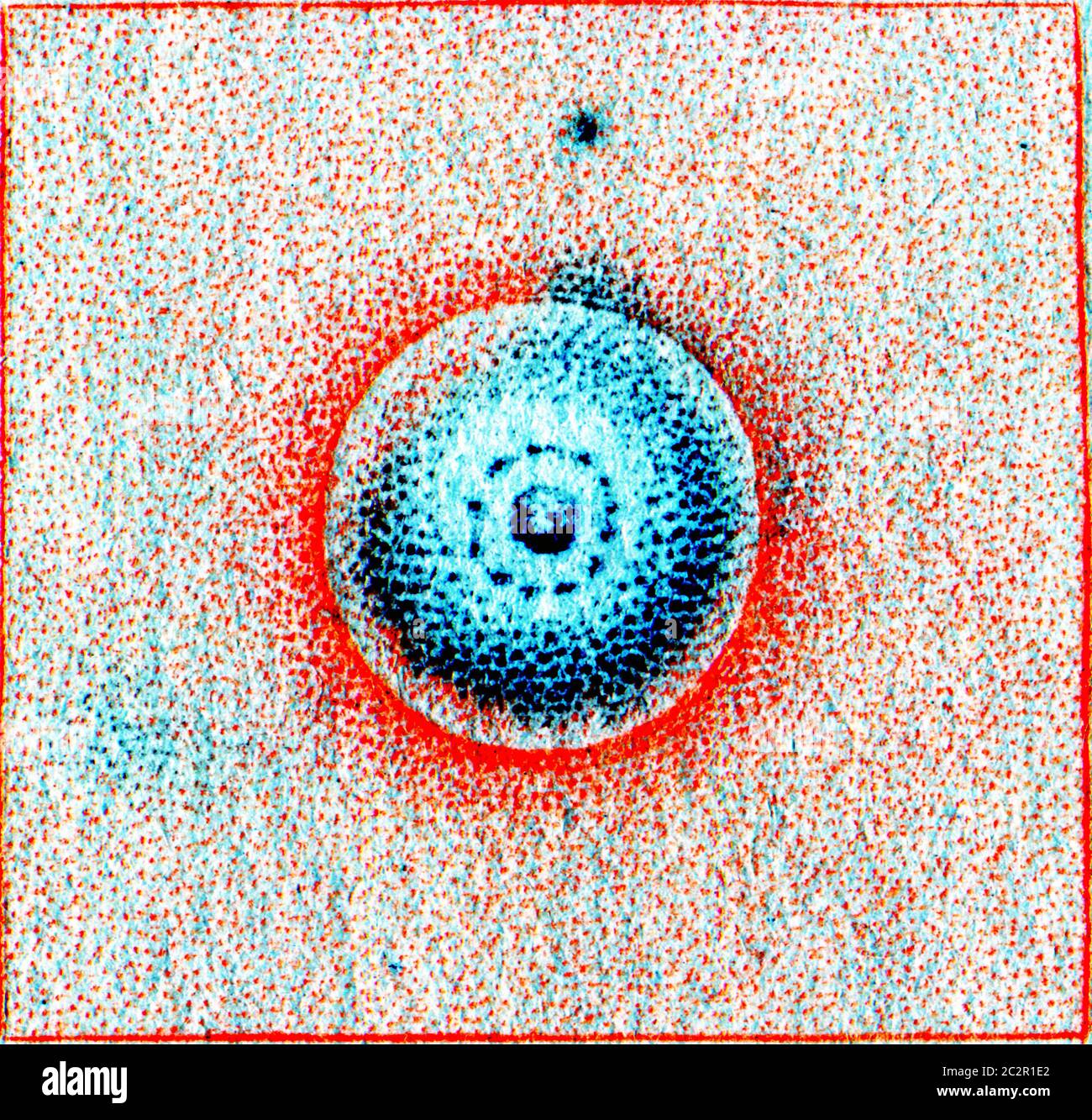 Cowpox from cows, vintage engraved illustration Stock Photo - Alamy