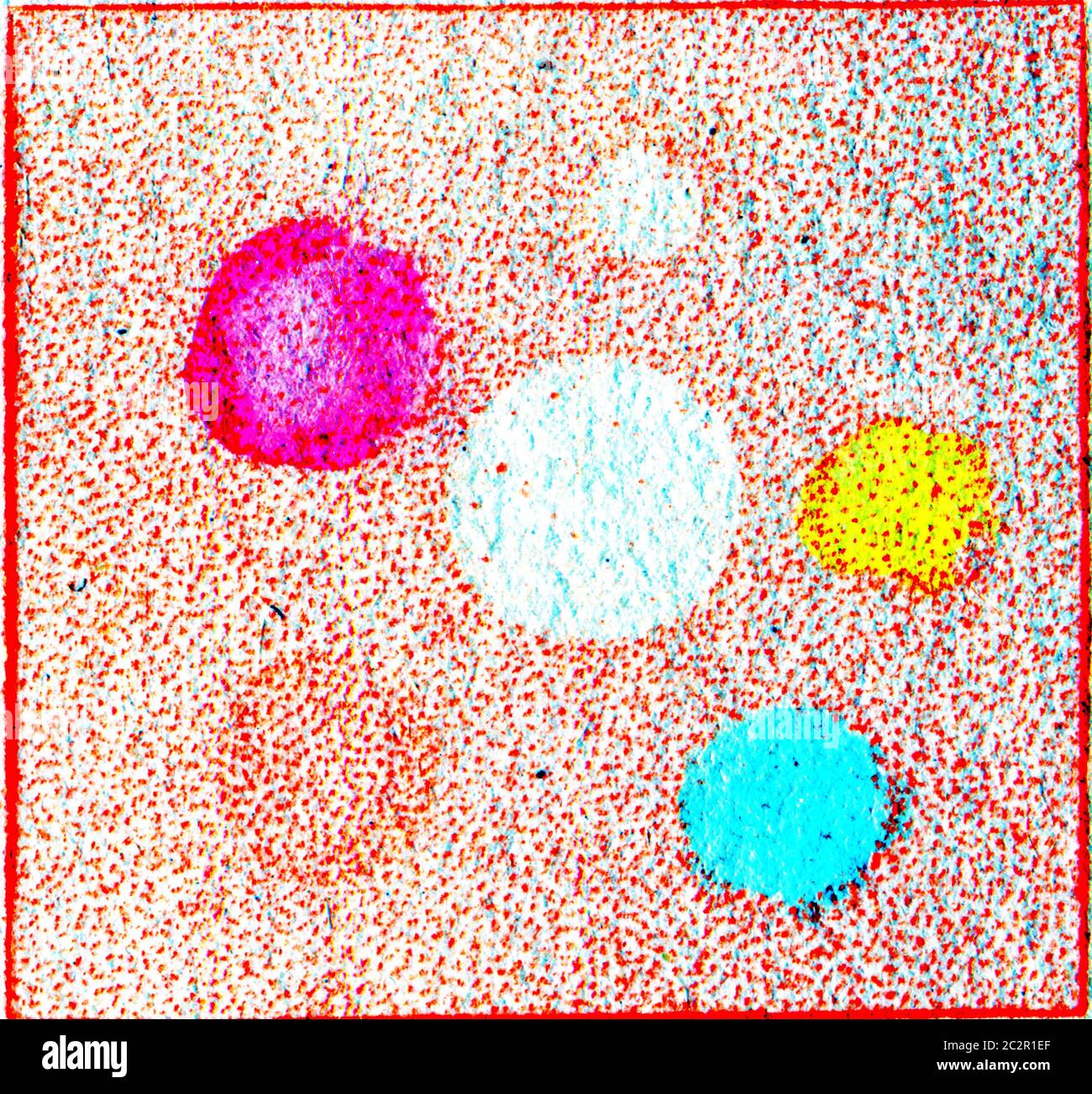 Petechiae hi-res stock photography and images - Alamy
