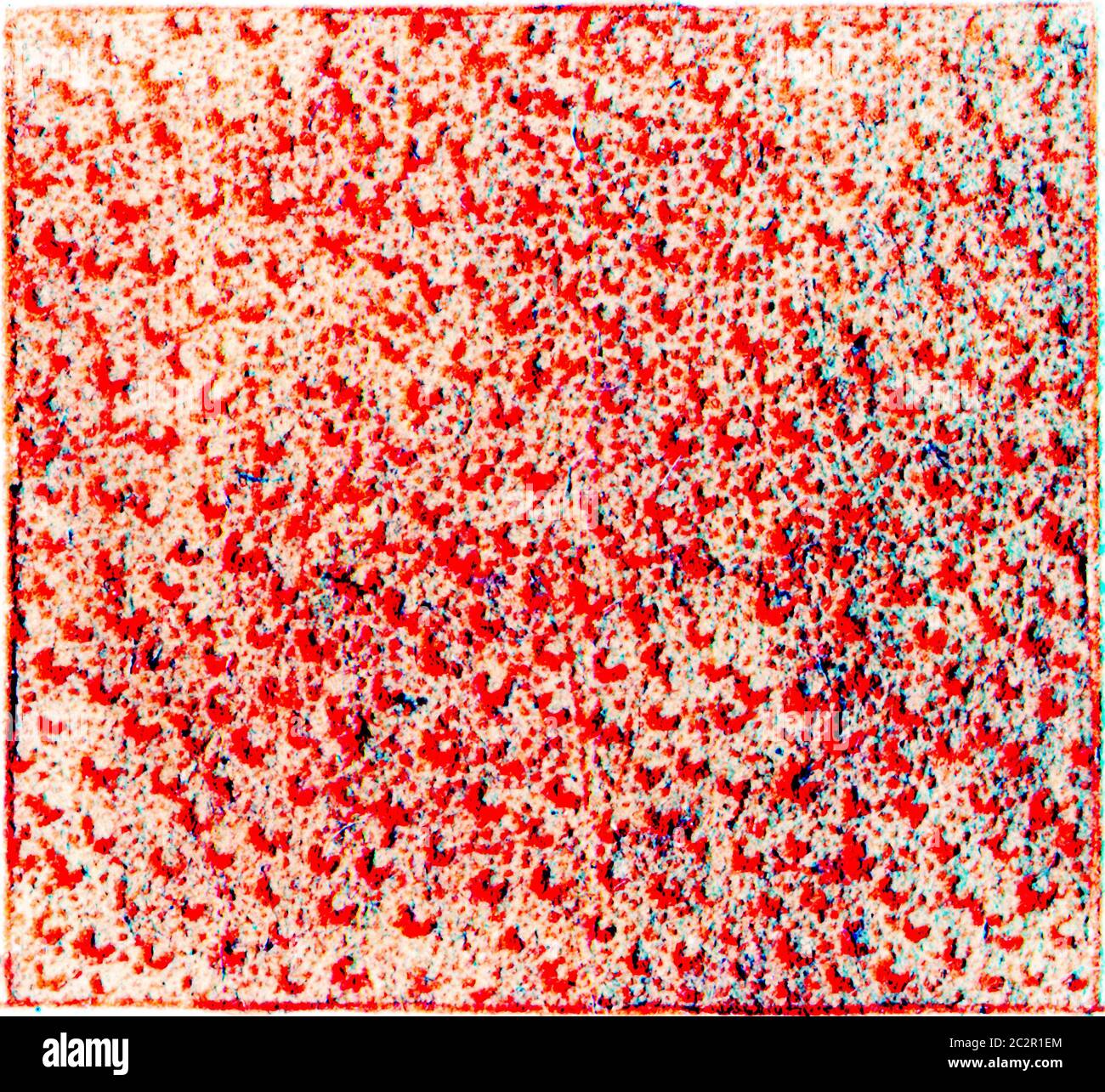 Scarlet fever hi-res stock photography and images - Alamy