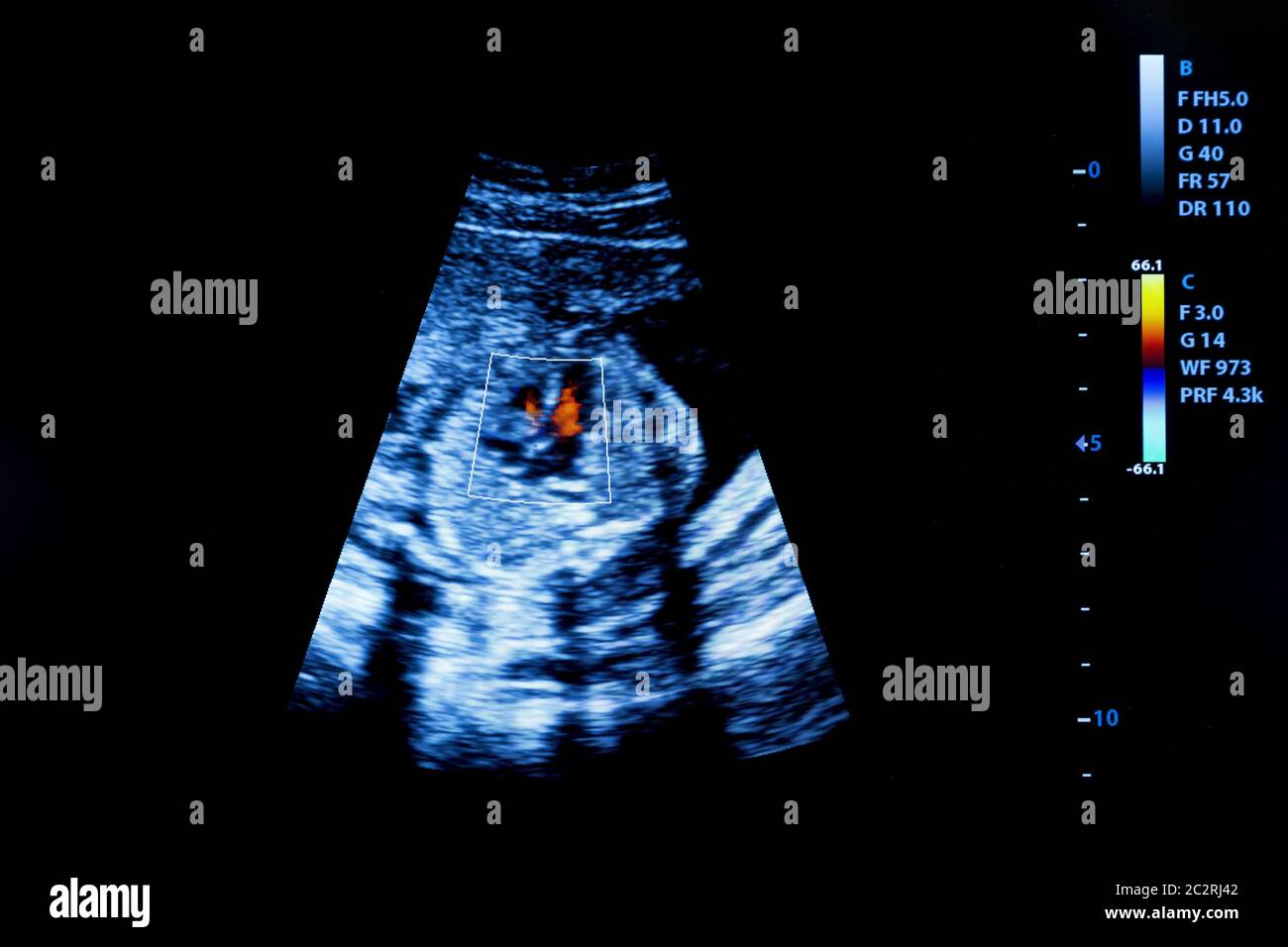 Colourful image of modern ultrasound monitor Stock Photo - Alamy