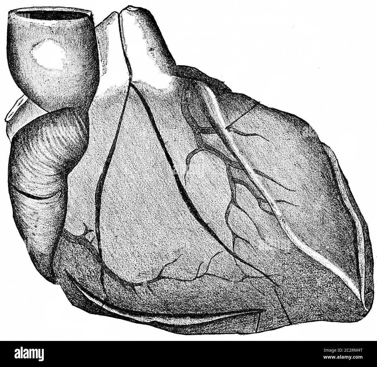 Heart showing the lines for incision in the preliminary examination and ...