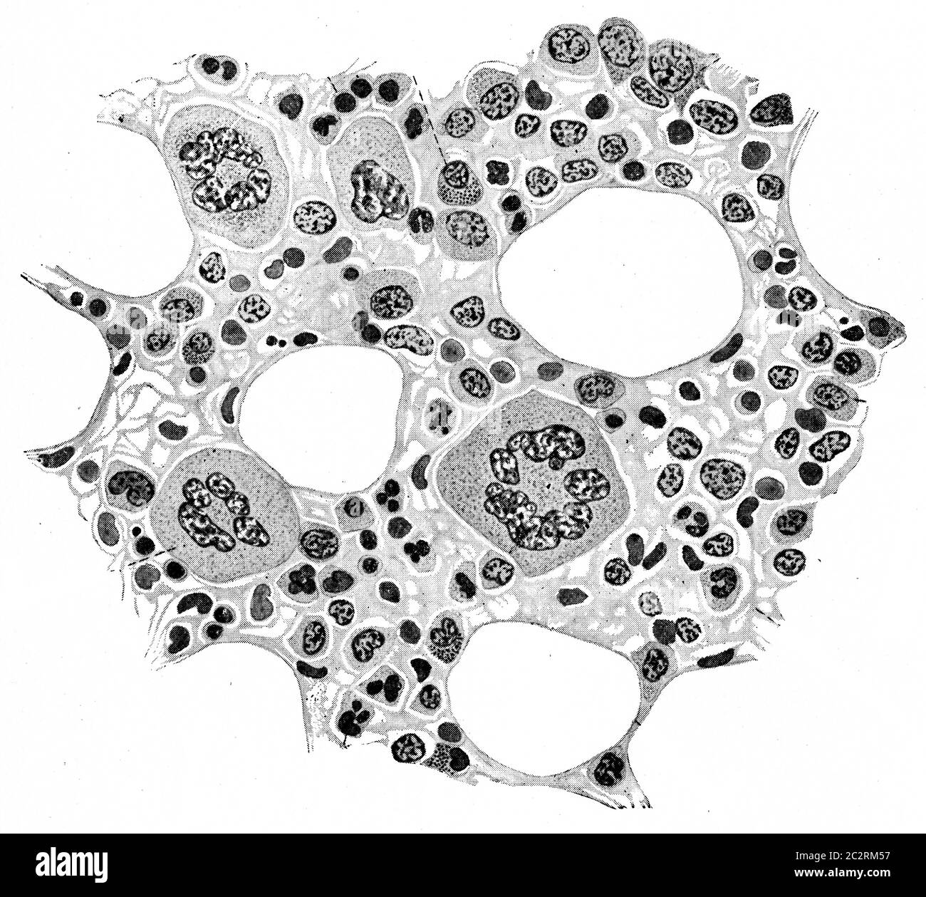 Section of bone marrow of rabbit showing the delicate connective tissue ...