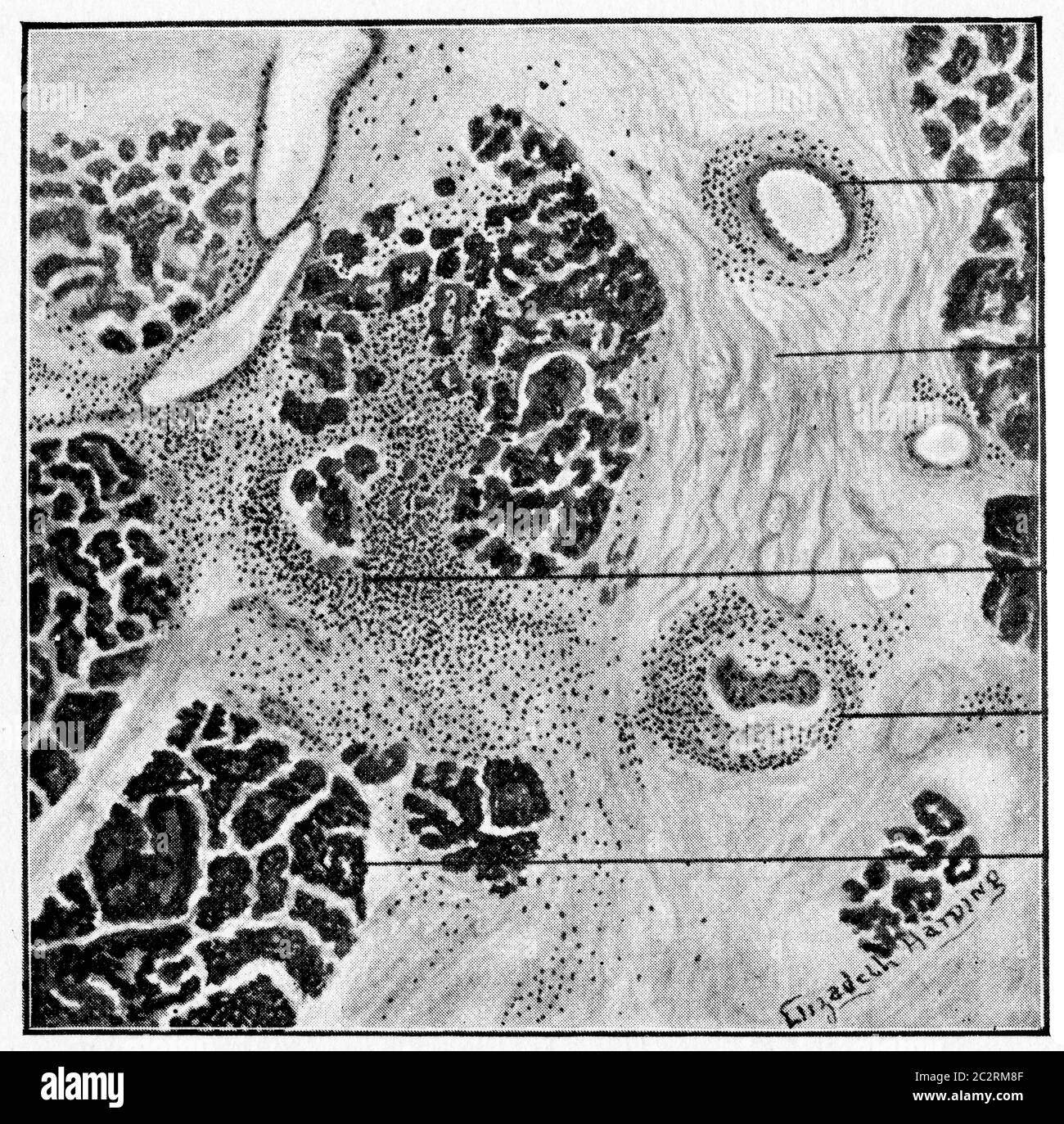 Section from right parotid, vintage engraved illustration Stock Photo ...