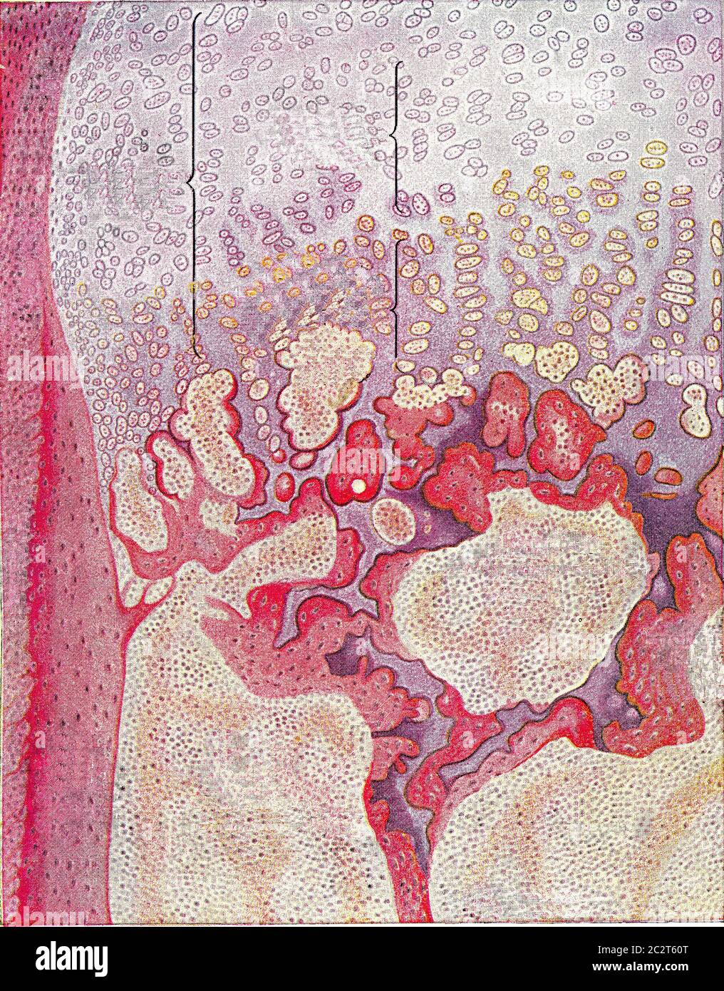 Cut of a finger fragment of a human embryo age of seven months, vintage ...