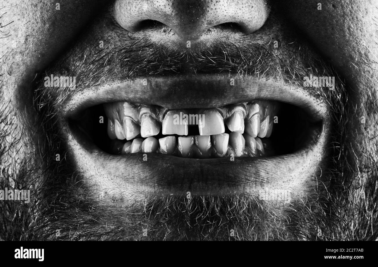 Scary teeth tooth Black and White Stock Photos & Images - Alamy