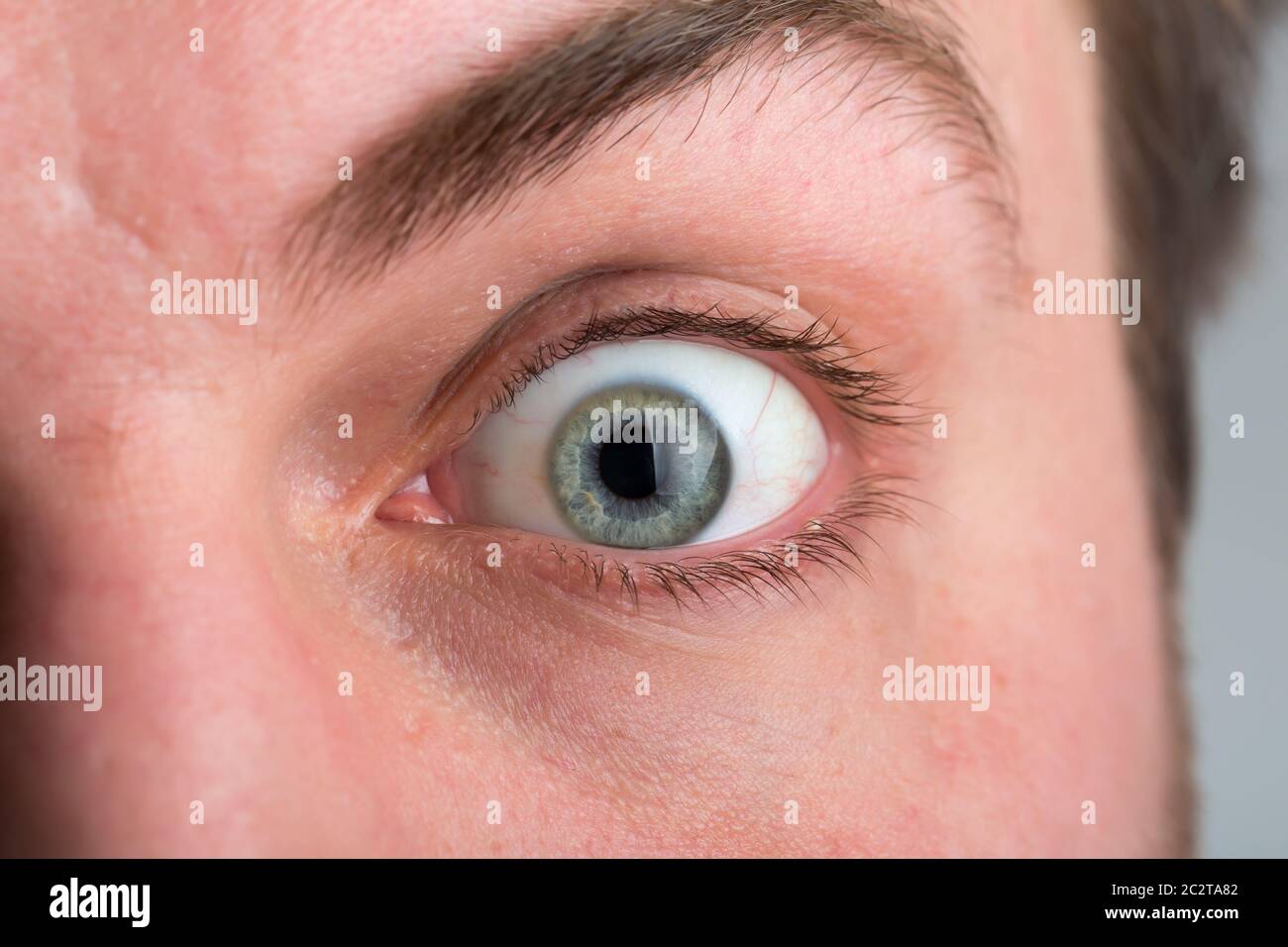 Closeup of surprised male eye Stock Photo - Alamy
