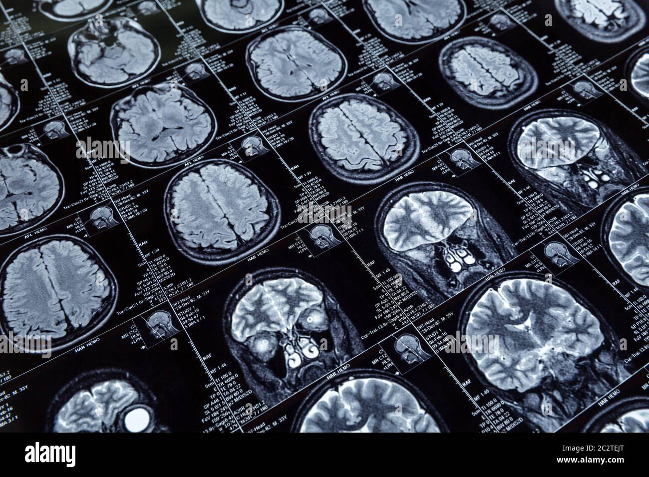 X-ray image of human brain Stock Photo - Alamy